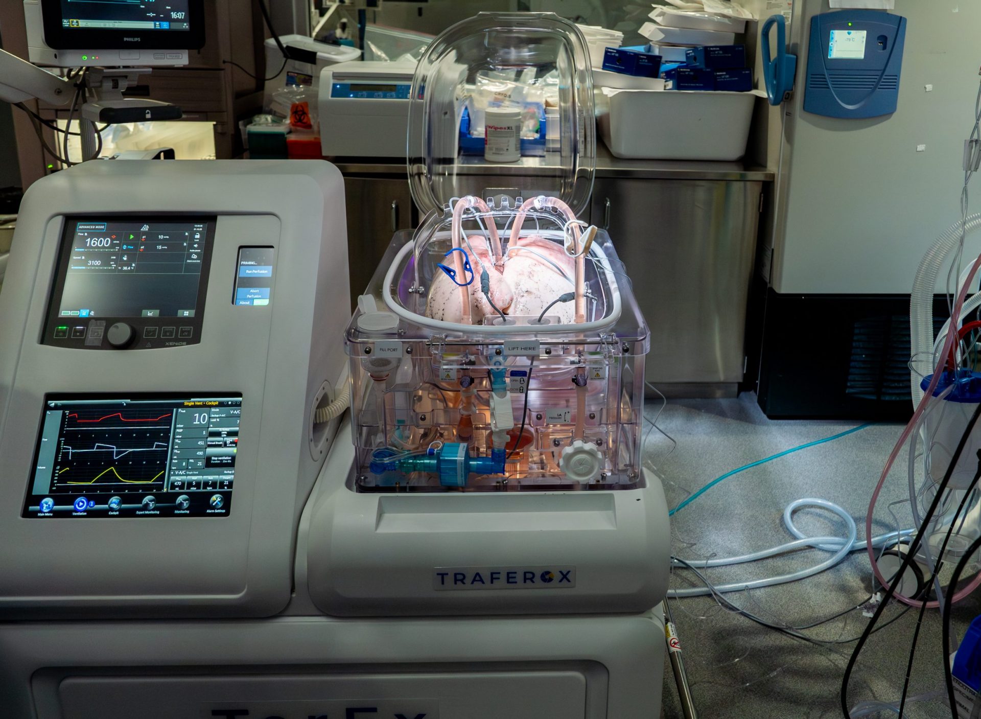 Keshavjee Lab - Latner Labs